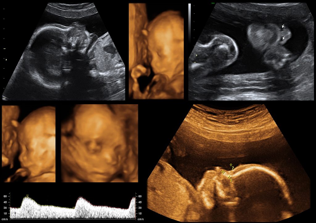 Sonograms & 3D Ultrasounds | Seven Oaks Women's Center | San Antonio TX